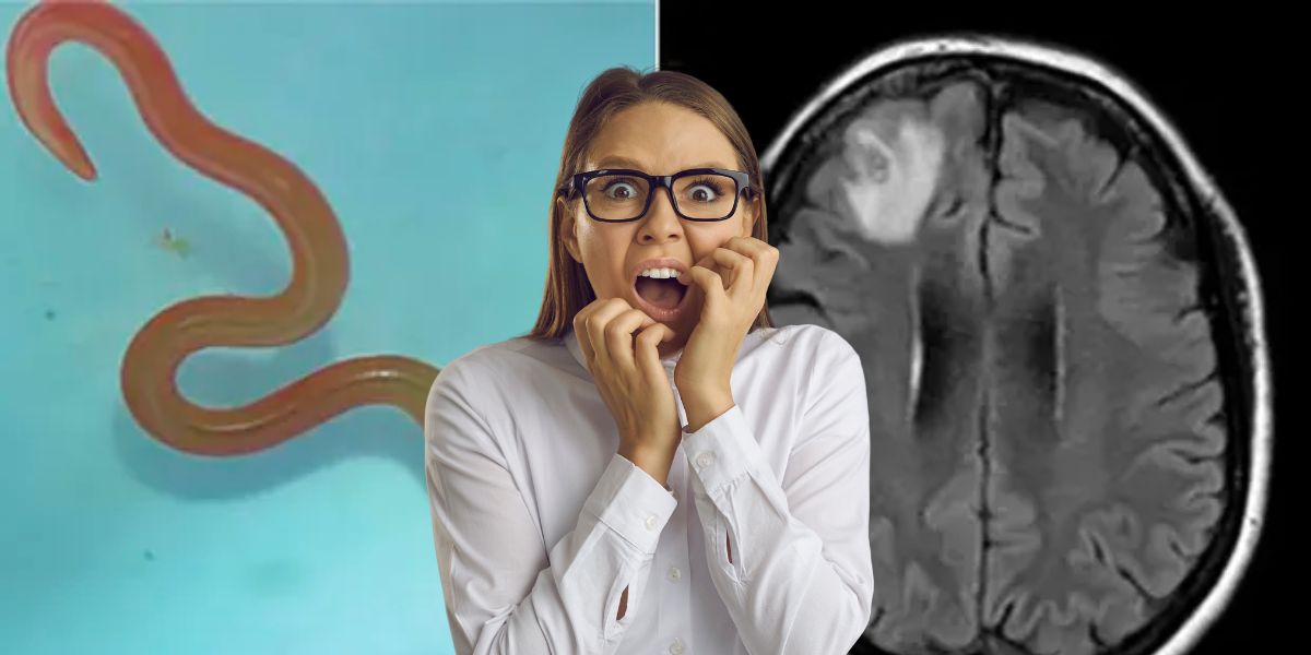 Doctors Find 8-Centimetre Worm in Aussie Woman’s Brain